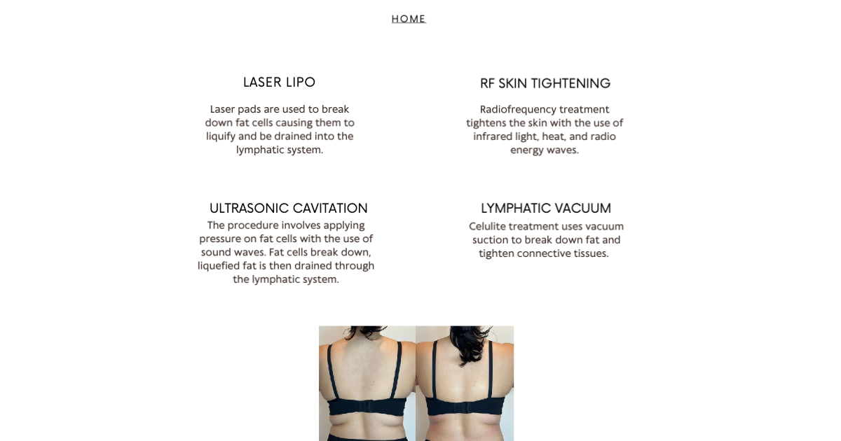 Slim, sculpt, and strengthen your physique Reduce persistent fat cells ...